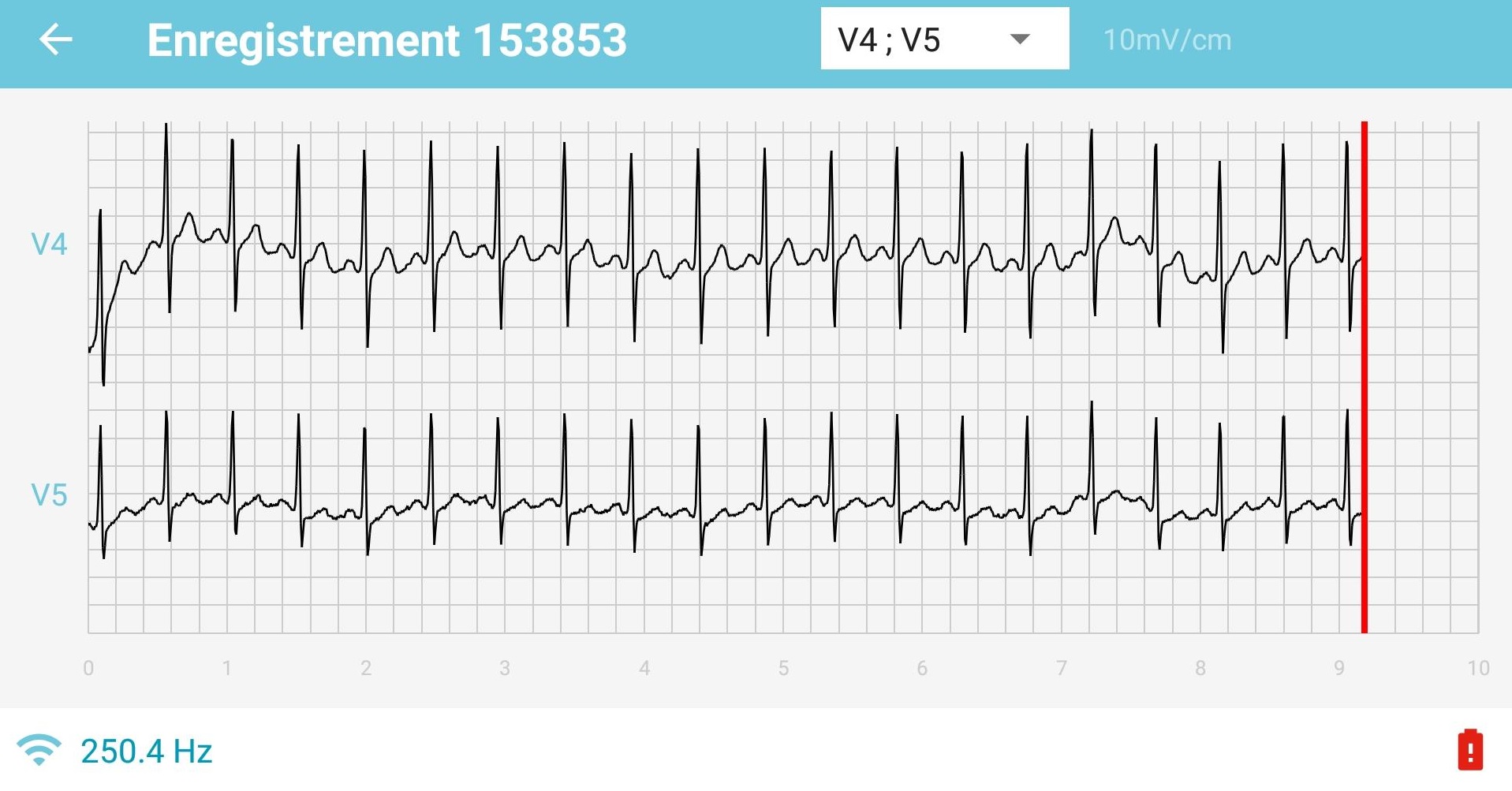 How to display the live ECG from the mobile application ? – HelpCenter EN
